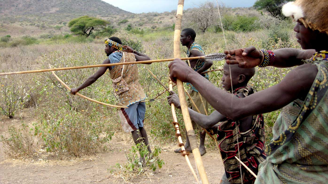 Why the microbes on your skin and in your body aren't the enemy