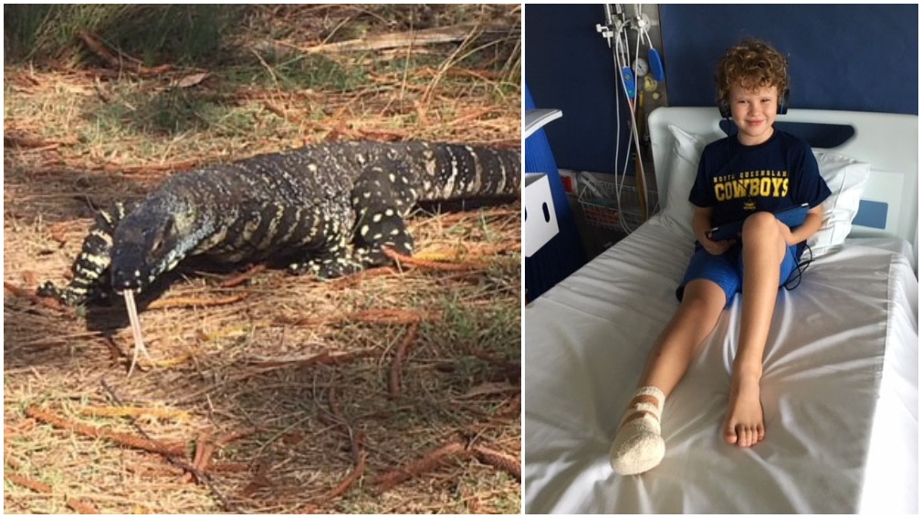 Goanna bites seven year old boy viciously: Father’s warning about wildlife