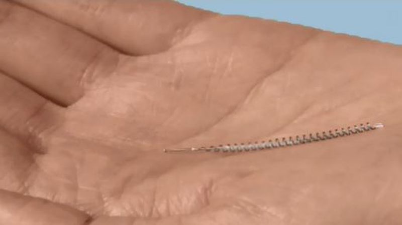 Essure Birth Control