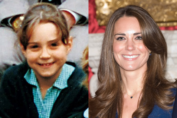 Kate Middleton As A Teenager Kate Middleton Reveals Cancer Diagnosis: