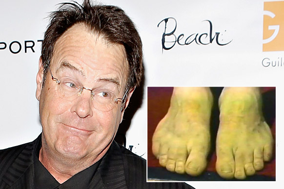 Dan Aykroyd Webbed Feet