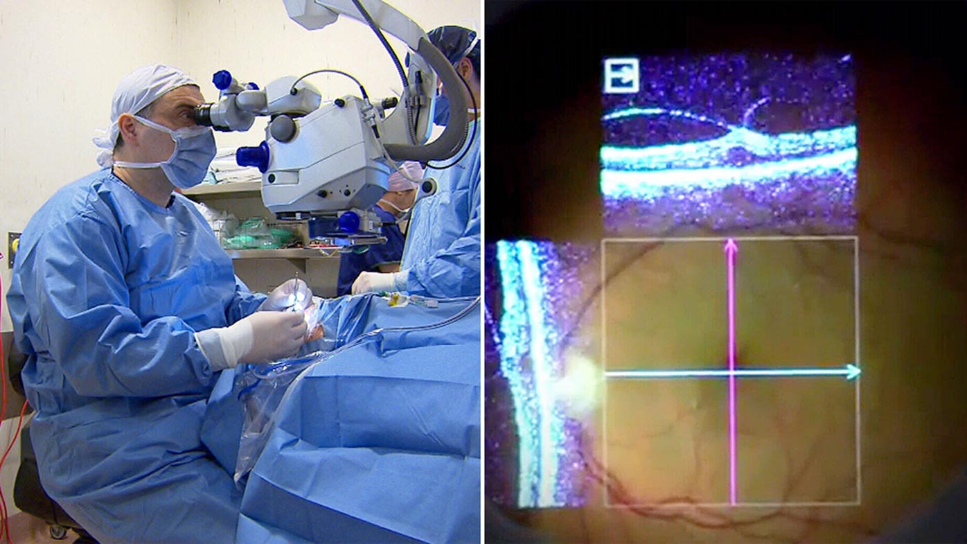 Melbourne News: New microscope a game-changer for Melbourne eye surgery