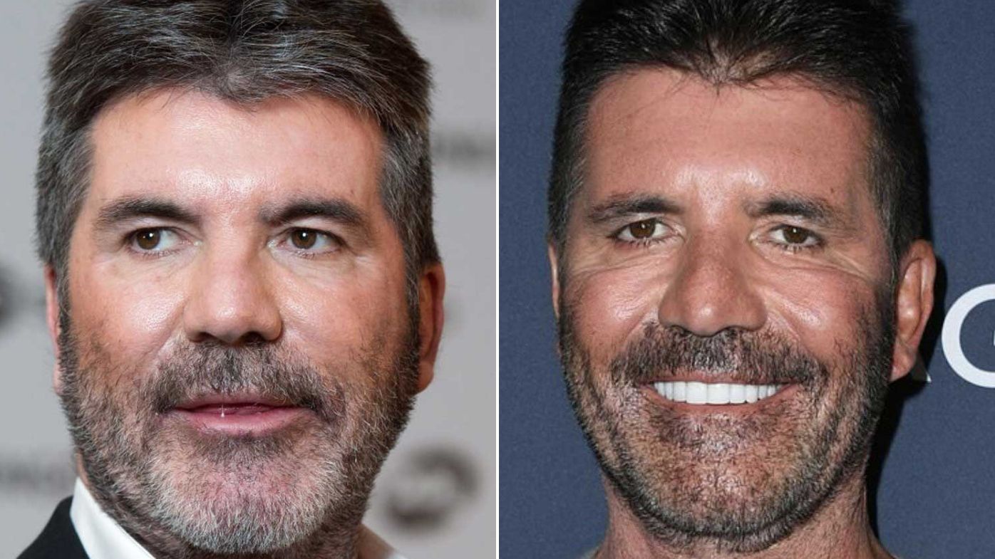 Simon Cowell is unrecognisable after going vegan - 9Celebrity