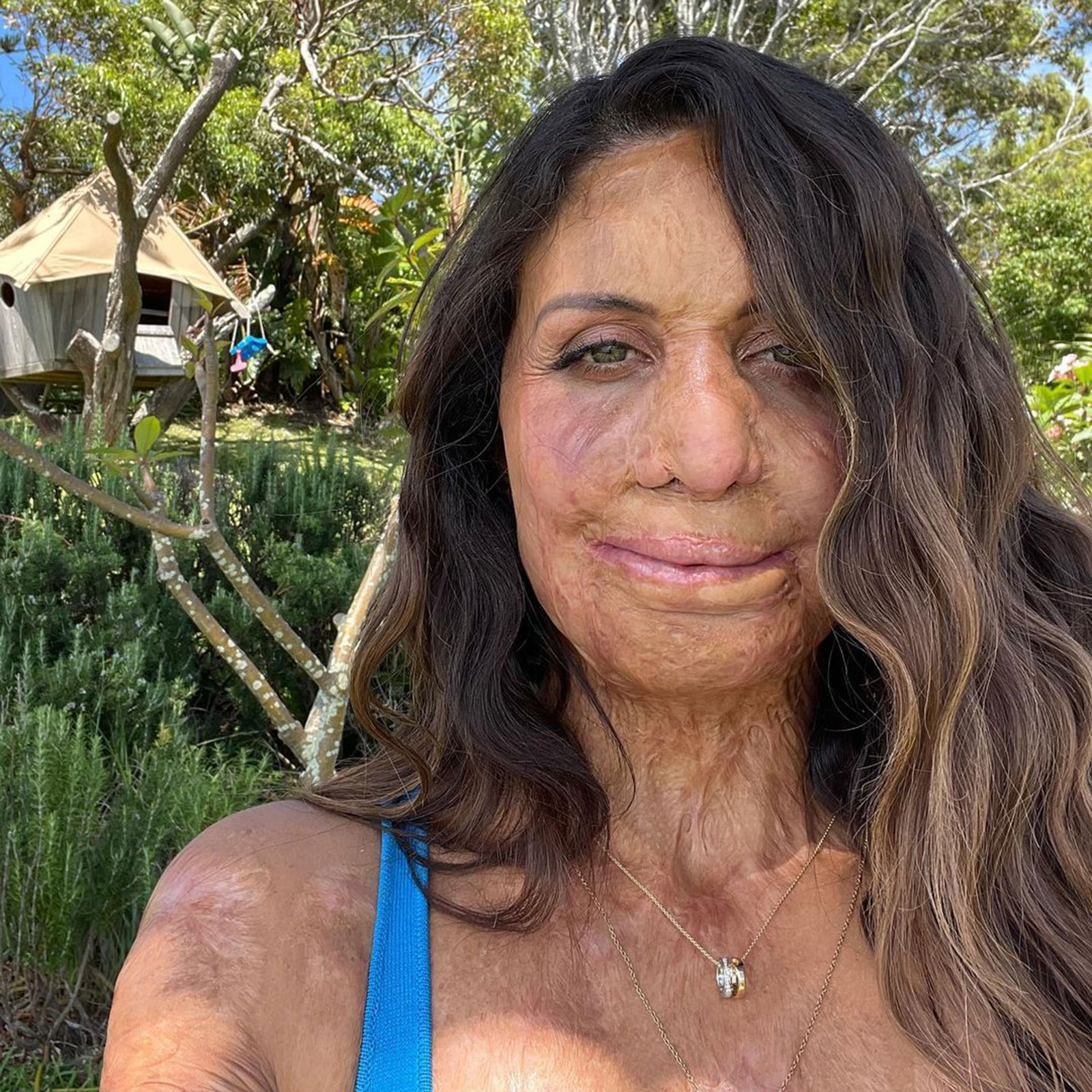 Turia Pitt recalls dark time after ultra-marathon fire ordeal: 'I don't ...