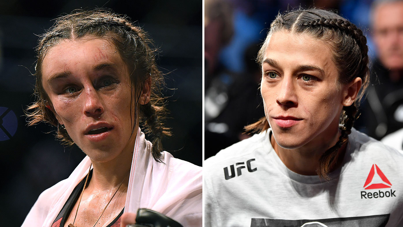 UFC: Joanna Jedrzejczyk's swollen forehead steals the show at UFC 248